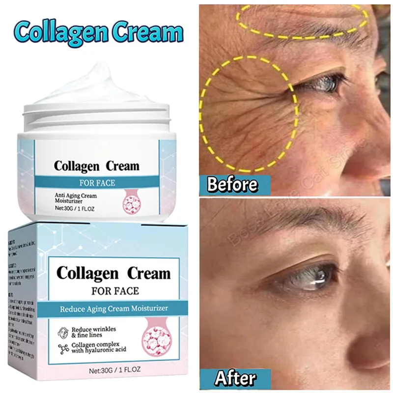 Wrinkle-Removal-Cream-Face-Remove-Anti-aging-Nasolabial-Folds ...