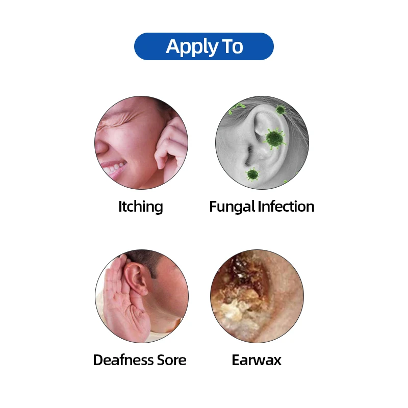 Fungal Otitis Externa Treatment