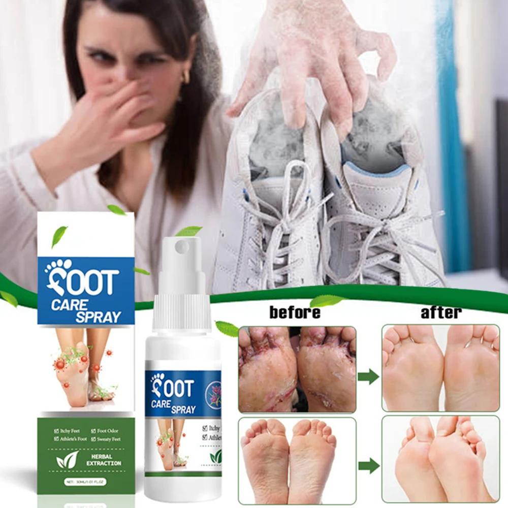 Foot-Deodorant-Spray-Prevent-Stinky-Feet-Non-Pungent-Fragrance-Anti ...