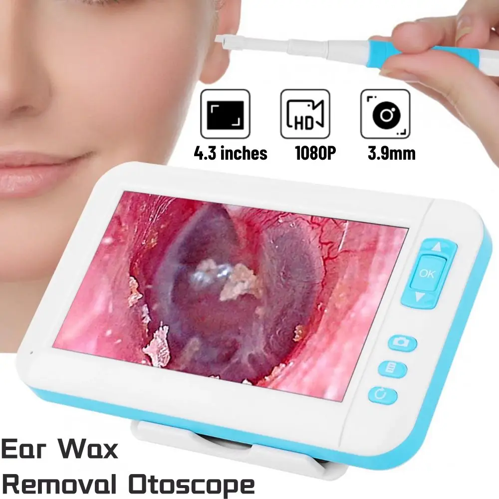 3-9MM-Digital-Otoscope-Ear-Cleaner-Endoscope-Camera-4-3Inch-Screen-Ear ...