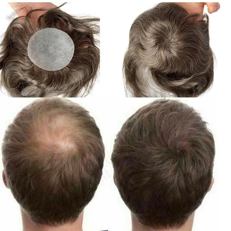 Pelucas-de-cabello-humano-europeo-para-hombres-y-mujeres-tup-de-piel ...