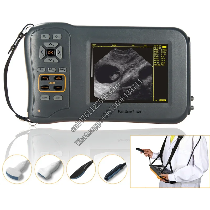 5-8-Inch-Farm-Portable-Ultrasound-Scanner-Machine-Sheep-Pig-Cow-Equine ...