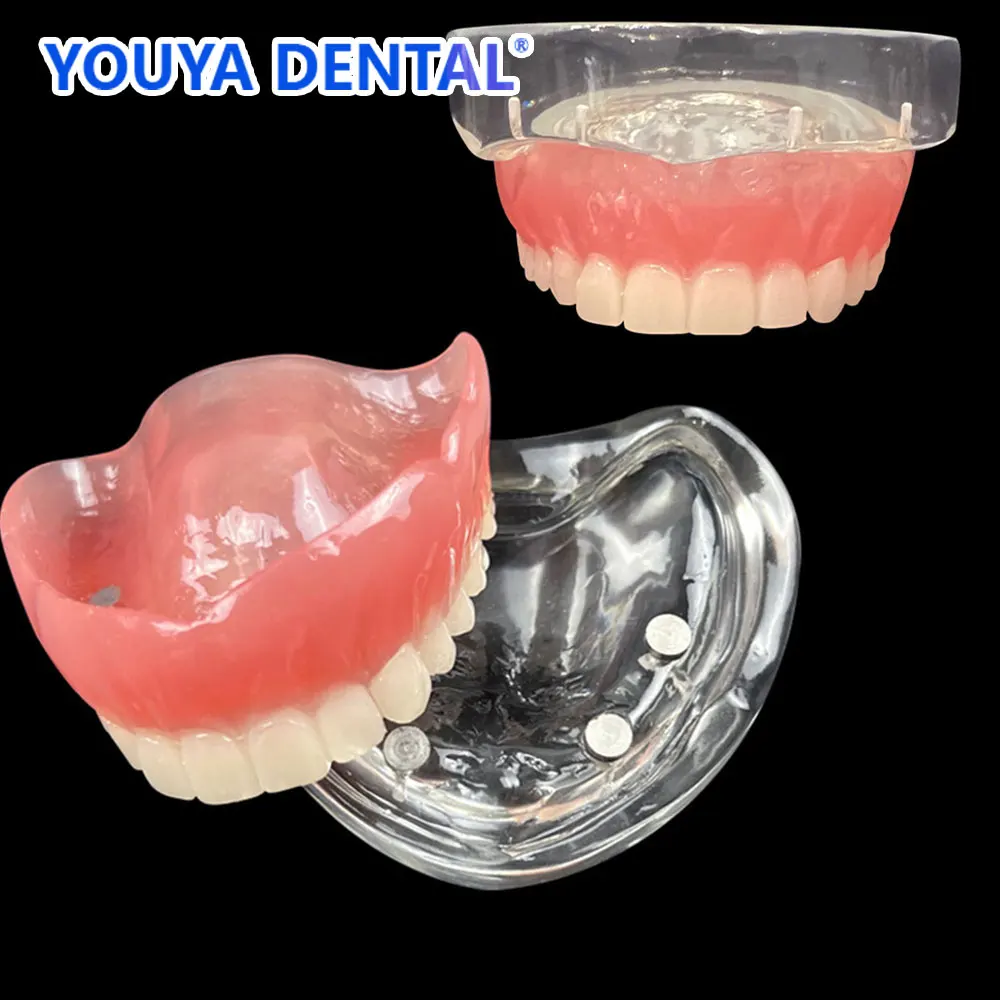 Dental-Upper-Overdenture-Teeth-Model-Magnetic-Adsorption-Removable ...