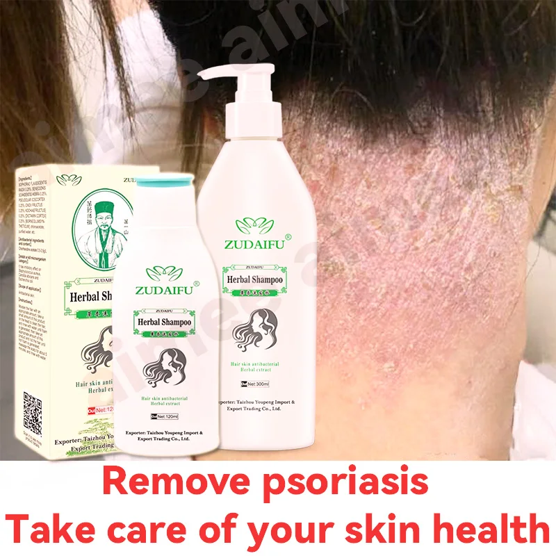 Eczema Shampoo