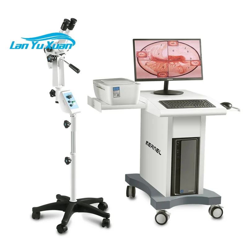 Optical-Colposcope-with-Software-Obstetrics-for-Gynecology-exam ...