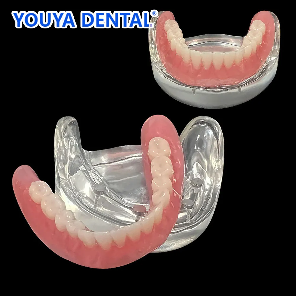Half-Denture-Magnetic-Dental-Lower-Teeth-Model-Inferior-Restoration ...