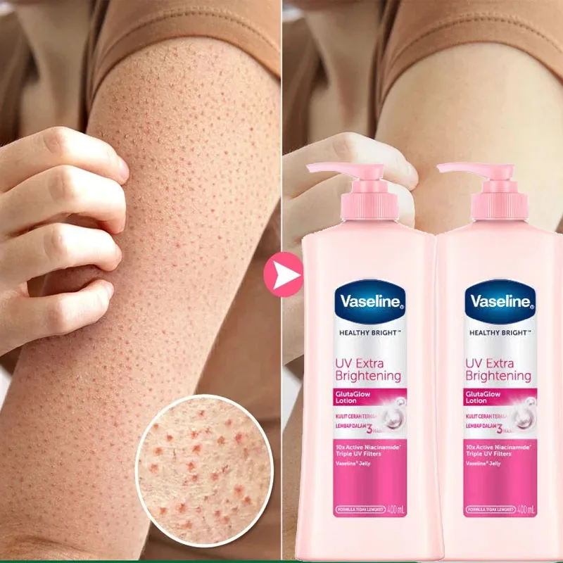 400ml-Whitening-Moisturizing-Chicken-Skin-Vaseline-Body-Lotion ...