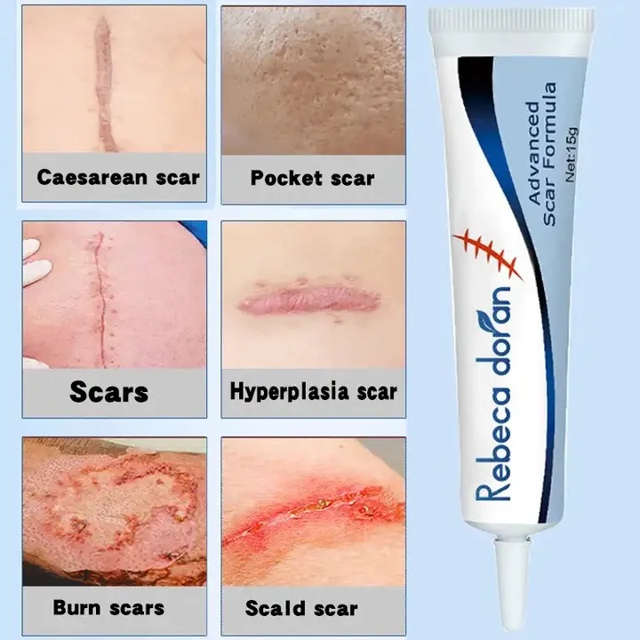 Surgical Scars Removal Cream Burn Scars Remover cream