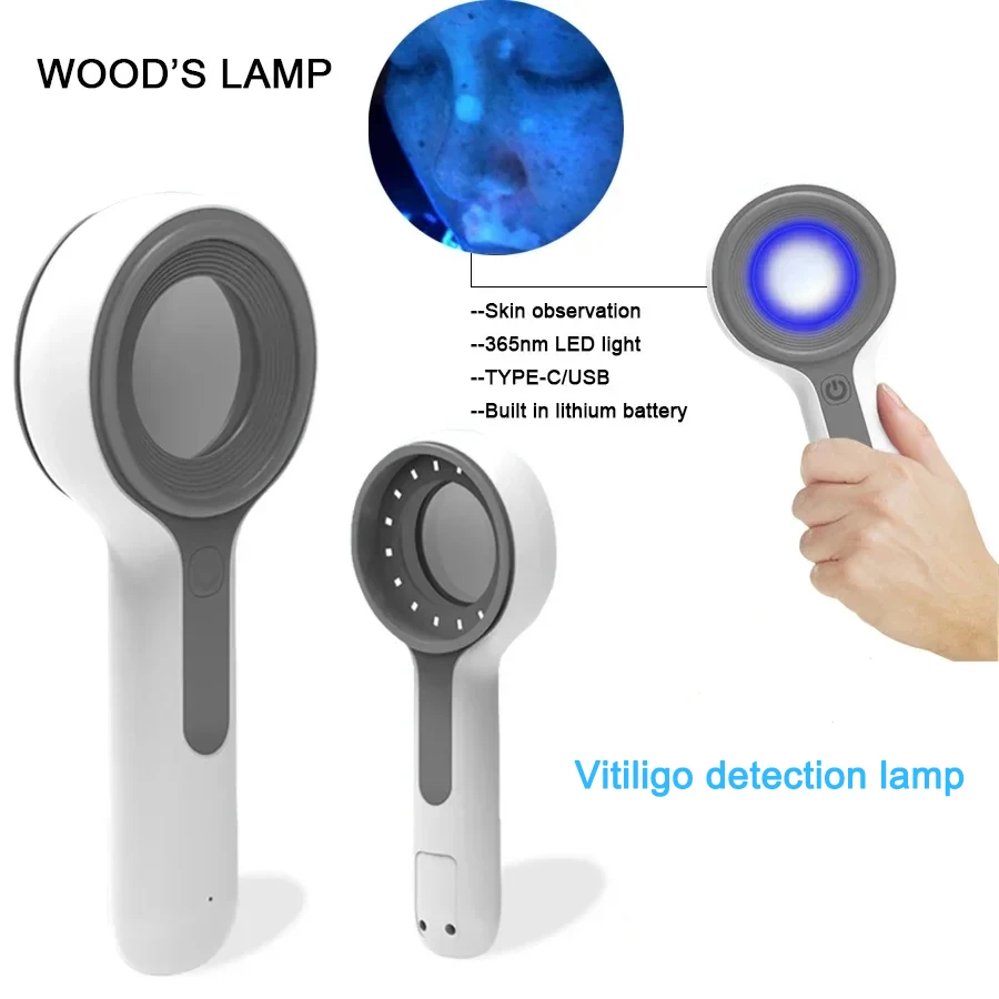 Wood-Lamp-Vitiligo-Detection-Lamp-Woods-Lamp-Skin-Analyzer-For-Skin-UV ...