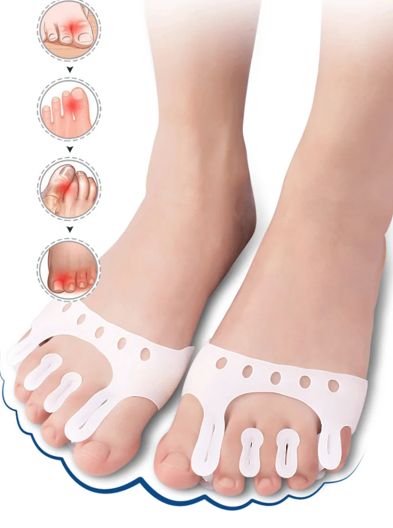 2Pcs=1Pair Silicone Bunion Corrector Toe Separator Gel Forefoot Pads ...