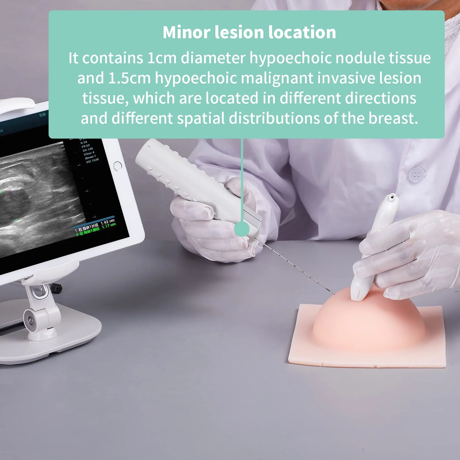 Labeled Breast Ultrasound Anatomy: A Real-World Guide to the Ultrasound ...