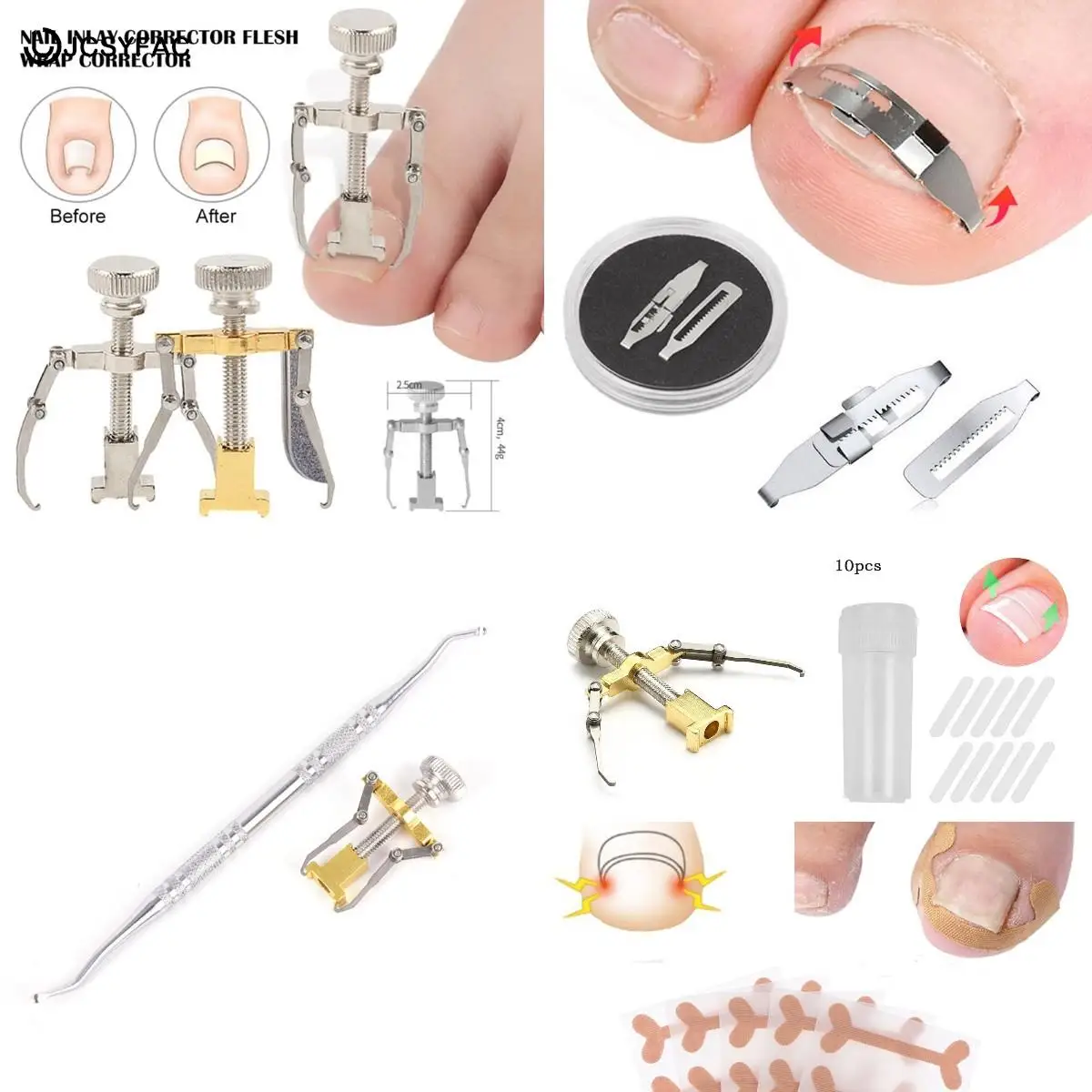 Ingrown Toenails Correction Tool Foot Toe Nail Care Tools Straightening ...