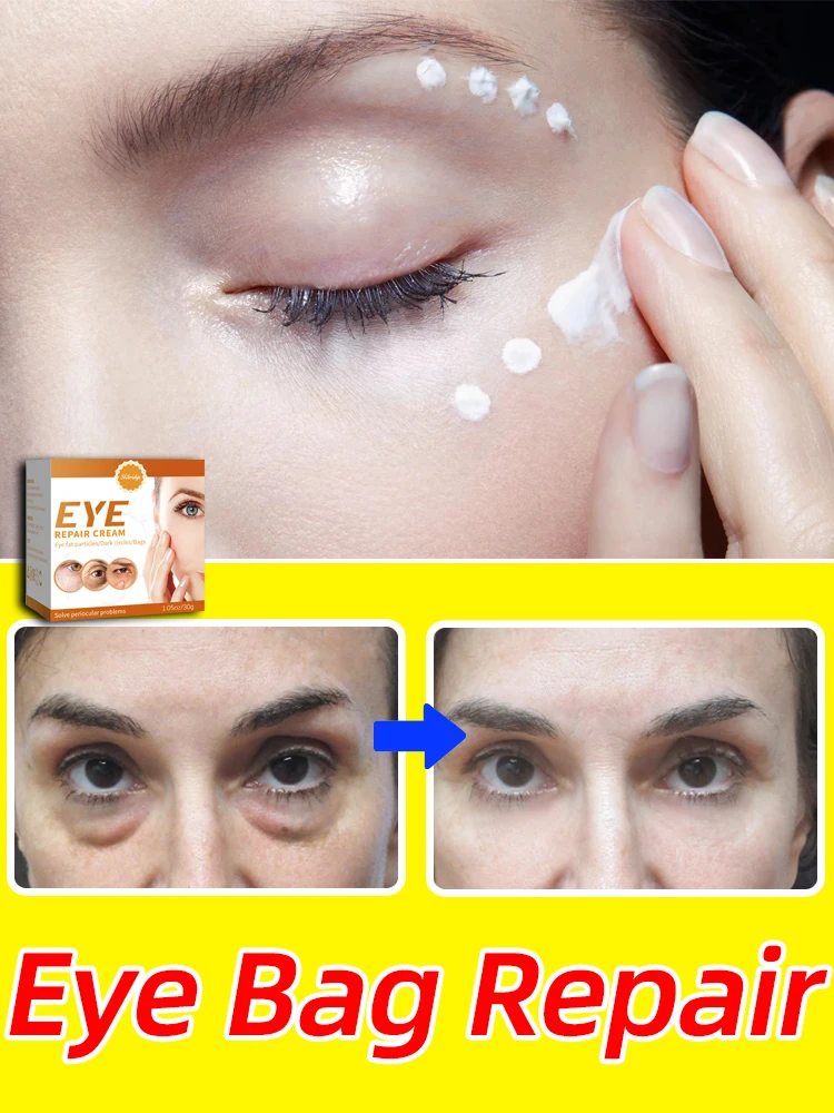 Eye-Cream-Bags-Anti-Dark-Circle-Puffy-Eyes-Care.jpg