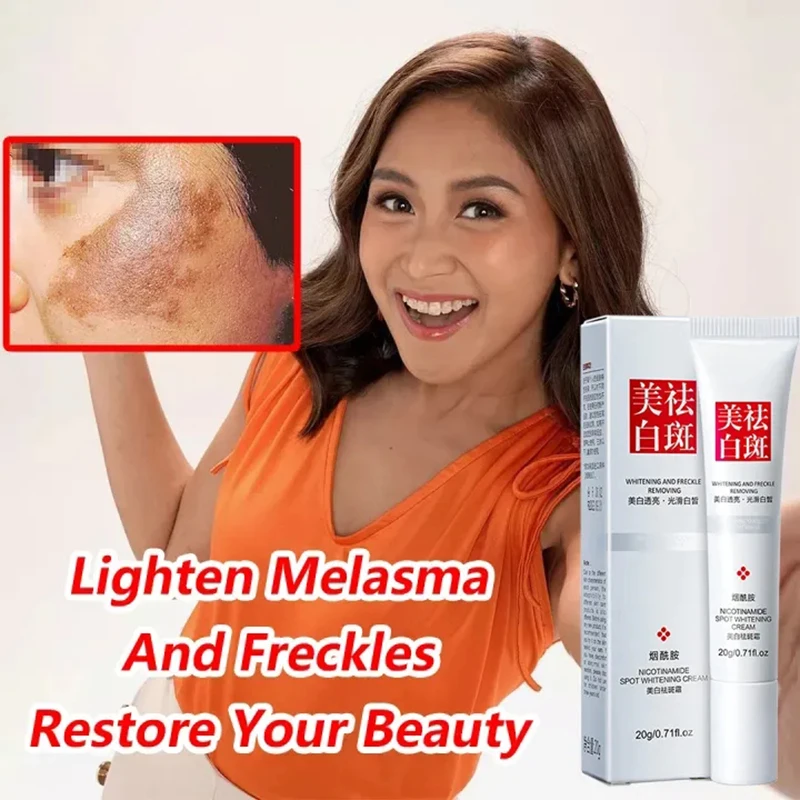 Whitening Freckle Cream Melasma Pigmentation Cream 7 Days To Improve ...