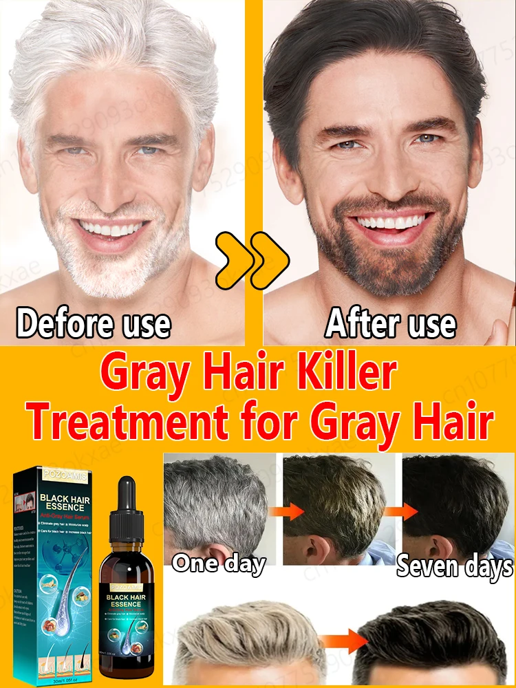 White-hair-treatment-essence-quickly-turns-white-hair-into-black-hair ...
