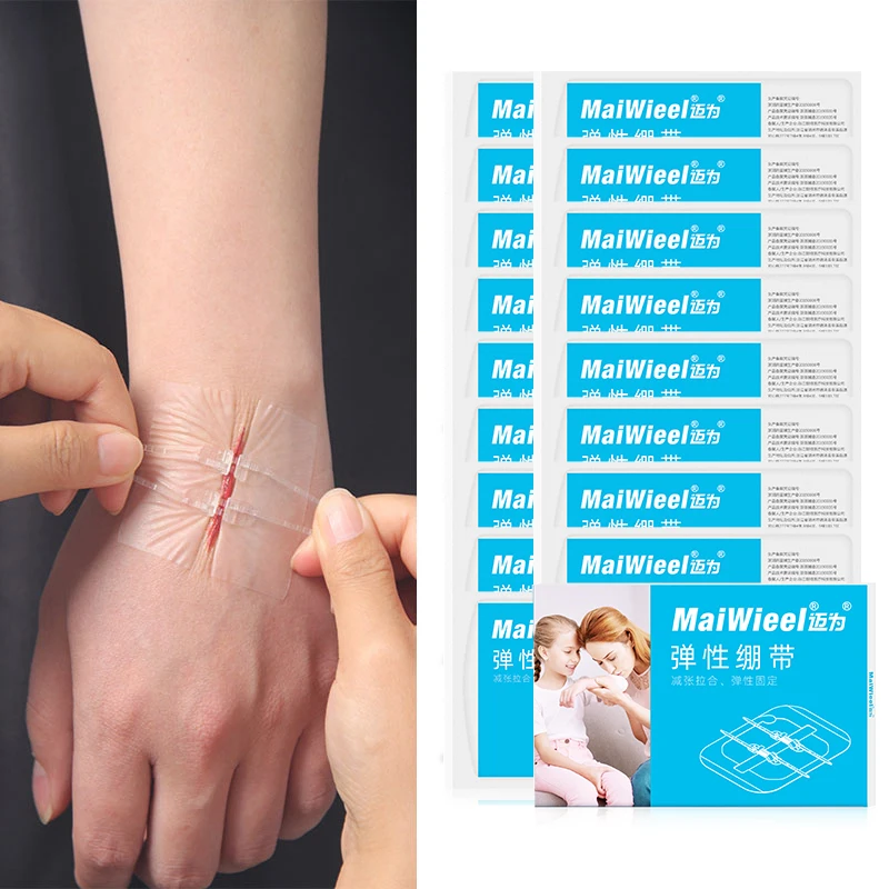 Painless Wound Closure Band-Aid Quick Close Zipper Band-Aid Outdoor ...