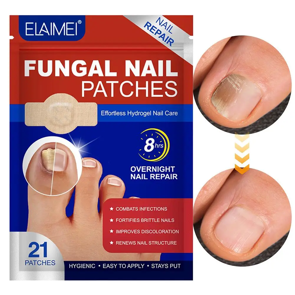Effective Anti Fungal Toenail Treatment: A Complete Guide to Clear ...
