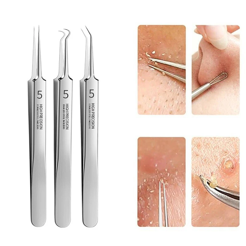 German-Ultra-fine-No-5-Cell-Pimples-Blackhead-Clip-Tweezers-Beauty ...