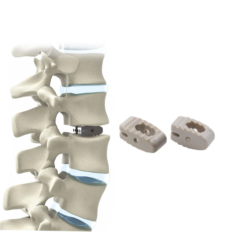 Orthopedic Anterior Cervical Fusion Cage Spine Cervical Cage Peek ...