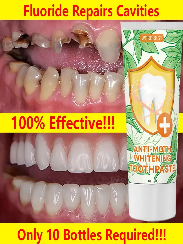 Fluoride-Repairs-Cavities-Toothpaste-Anti-cavity-Clean-Plaque-Relieve ...