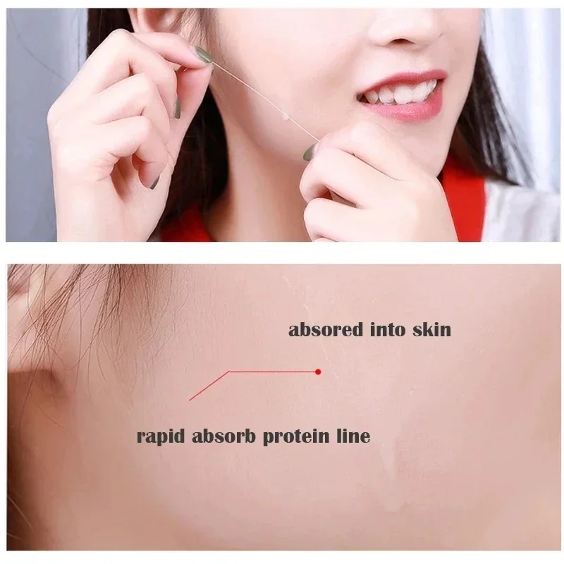 Collagen Thread Instant Lifting Wrinkle Remover Soluble Protein Threads ...