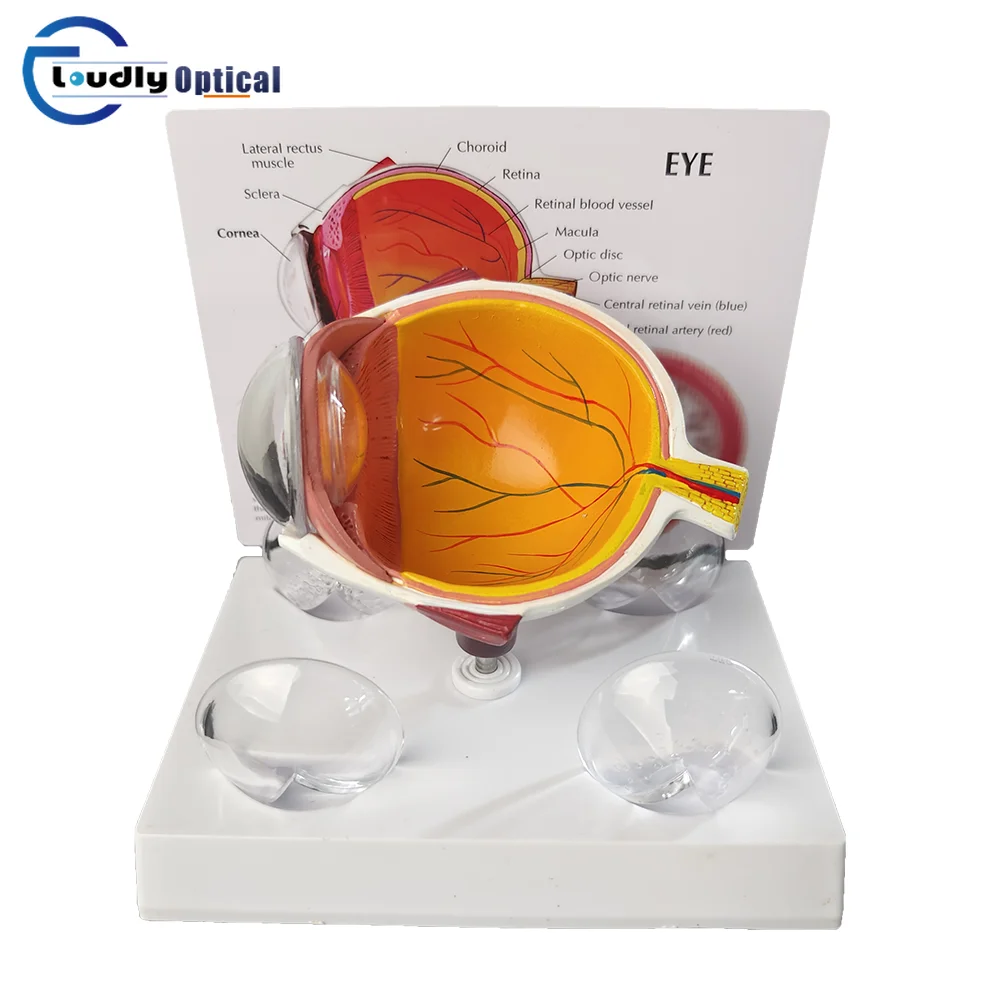 Corneal-Eyeball-Model-Lesion-Anatomical-Model-Ophthalmology-Clinic ...