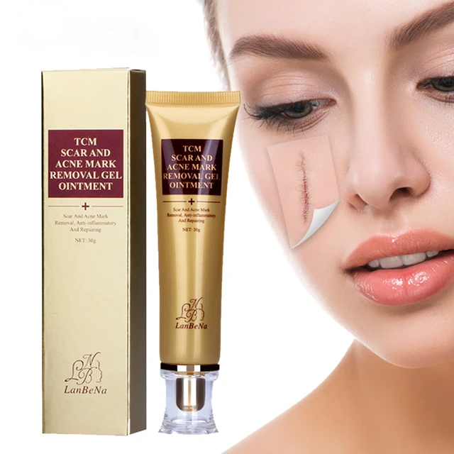 Acne Scars Removal Cream