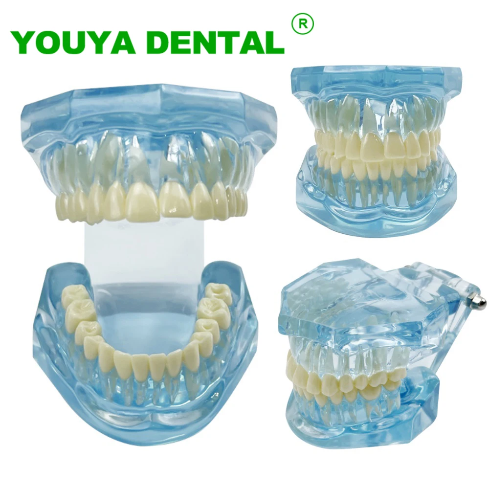 Dental-Demonstration-Model-Normal-Standard-Teeth-Jaw-Typodont-Model ...