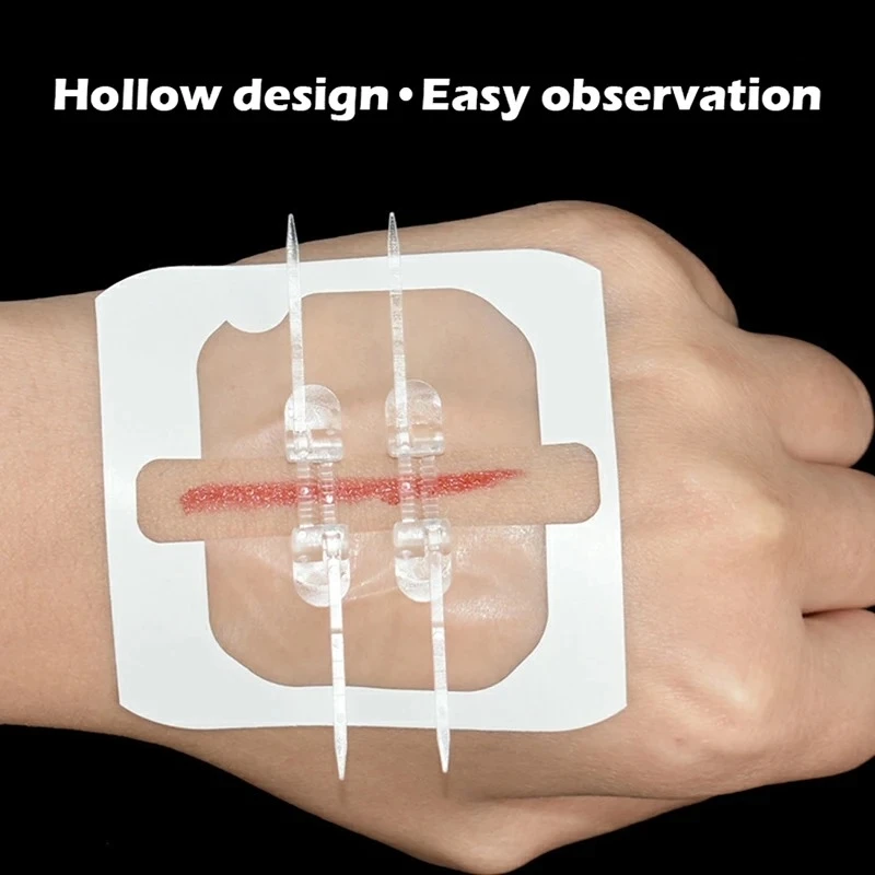 2-10 adhesive bandages with zipper, wound closure device, no need for ...