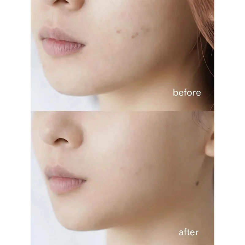 100% Original Correct Anti-Aging Face Cream Replenishment Treatment ...