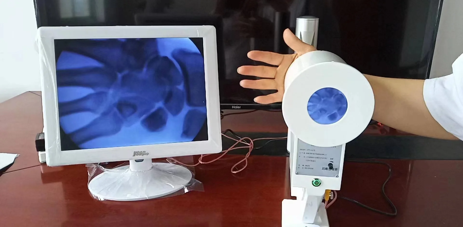 x-ray-machine-fluoroscopy-instrument-industrial-portable-x-ray-machine ...