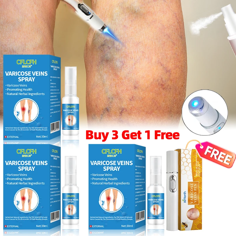 3Pcs-Varicose-Veins-Spray-Relieve-Legs-Pain-Improve-Blood-Circulation ...