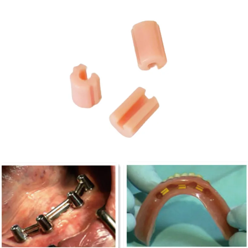 Clip-de-barra-Dental-accesorio-de-precisi-n-para-jinete-mujer-color ...