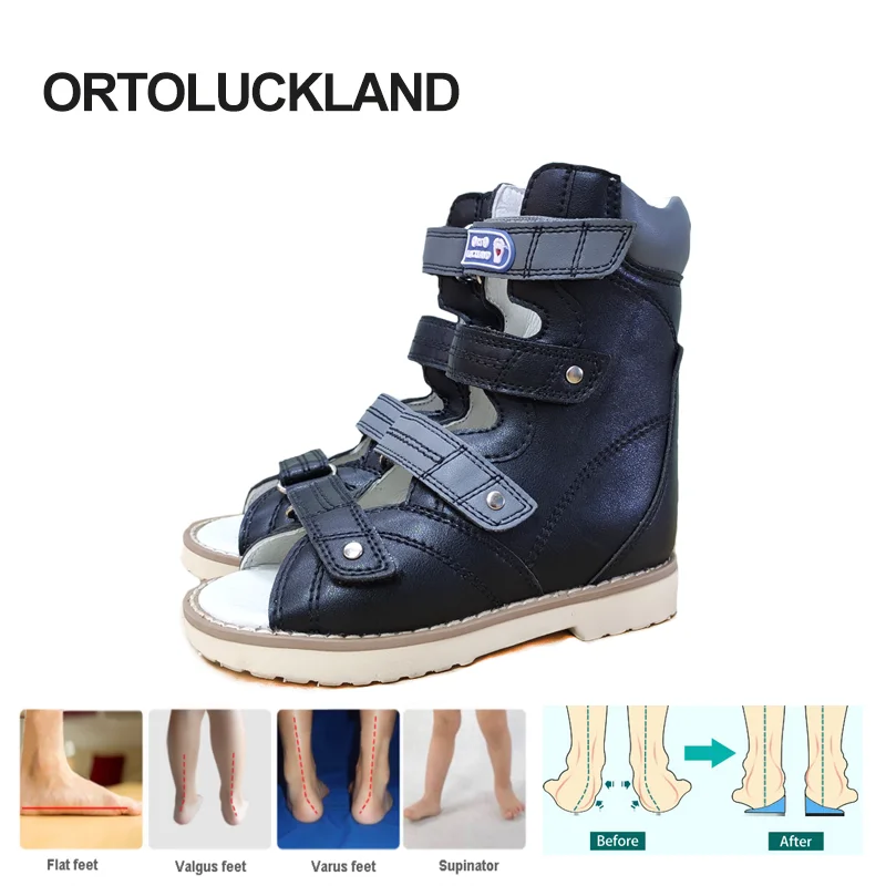 Boy-Sandals-Orthopedic-Shoes-For-Kid-High-Top-Summer-Leather-Children ...