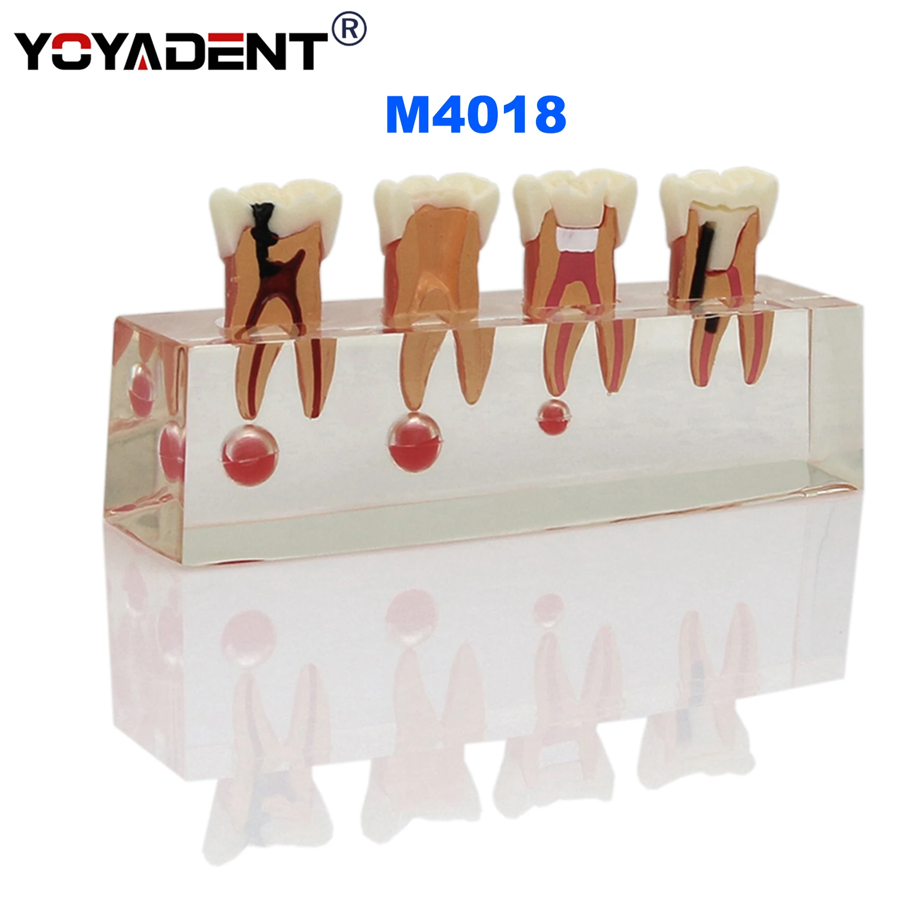 Dental-Teeth-Model-4-stage-molar-rootcanal-treatment-Model-Dentists ...