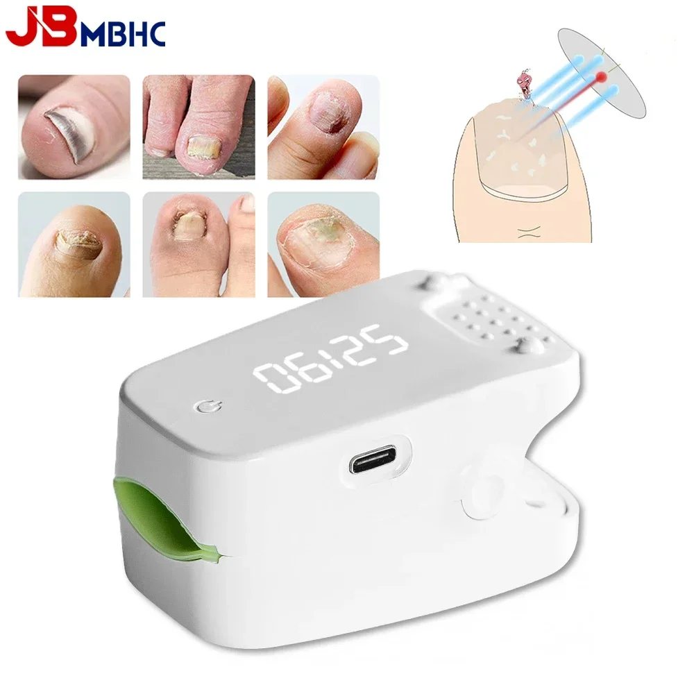 Feet-Nail-Fungus-Laser-Nail-Therapy-Device-Foot-Care-Removal-Device ...