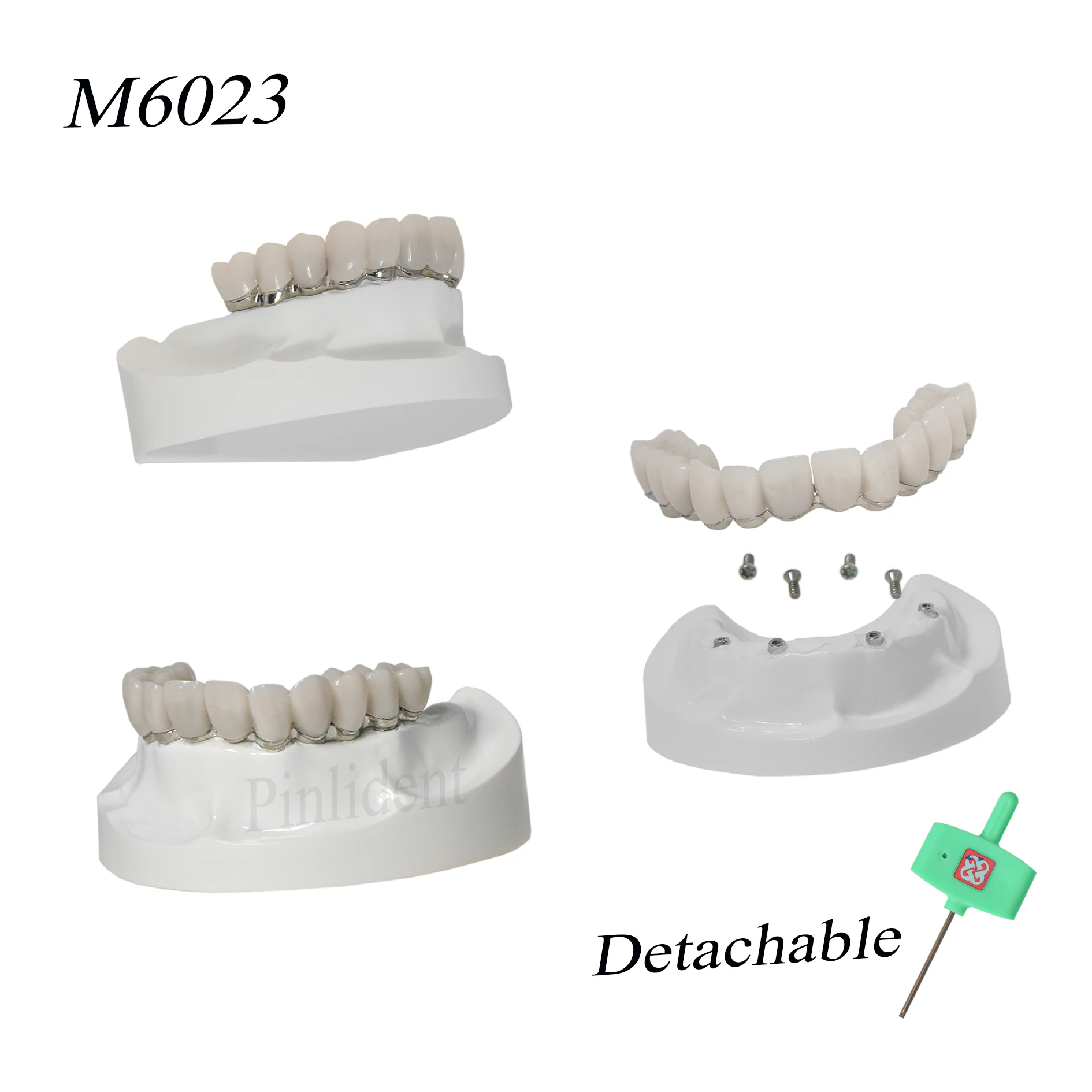 Maxillary-Implant-Prosthetic-Model-Implant-Model-Overdenture-Hands-on ...