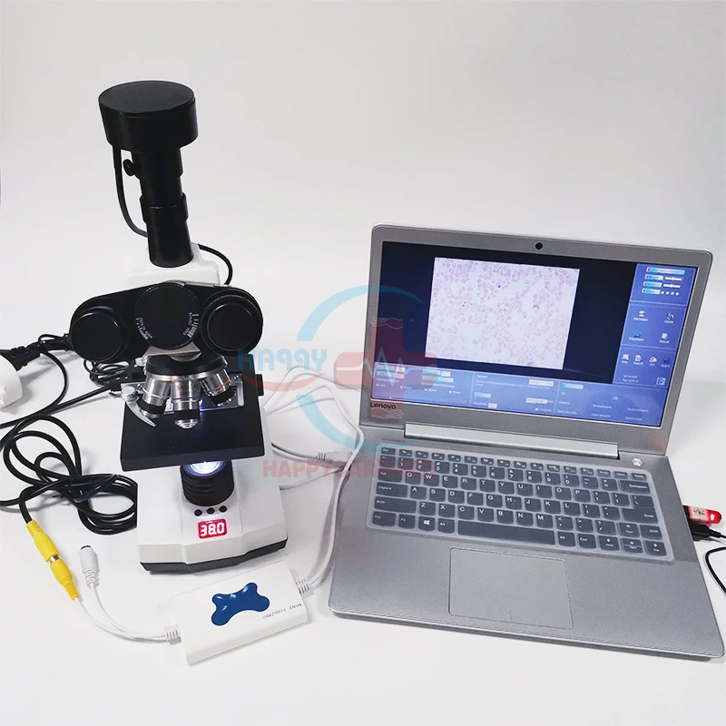 HC-B028V-Mammal-Sperm-Quality-Analysis-System-Canine-Semen-Microscope-Analyzer-Veterinary-Sperm ...