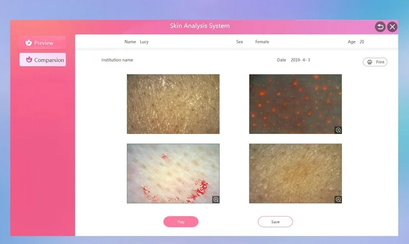 WIFI Wireless Portable Skin Aesthetic Analyzer Digital Skin Scanner Facial Diagnosis Detector ...