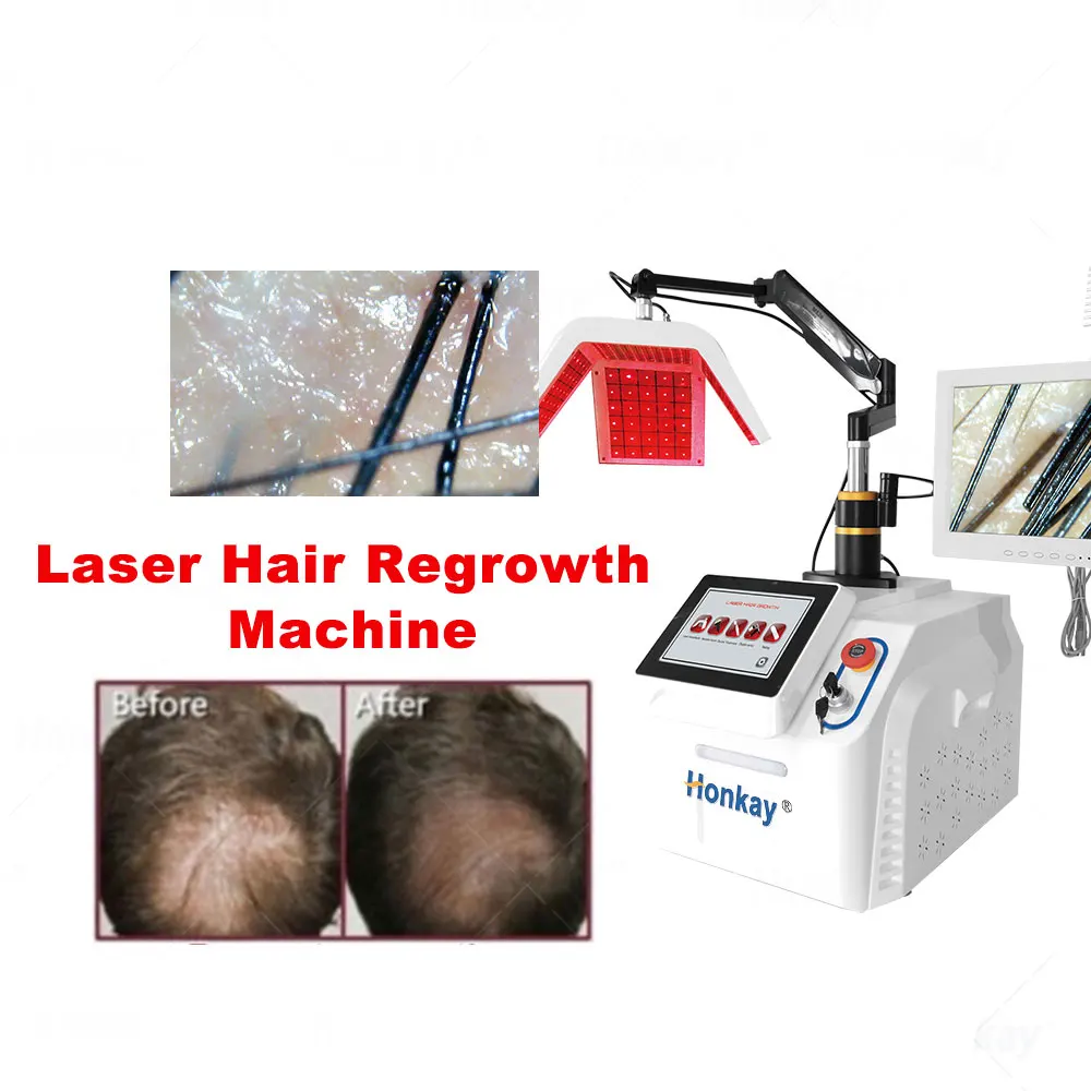 Professional-Hair-Growth-Machine-650nm-Cold-Diode-Laser-Red-Light-Anti ...