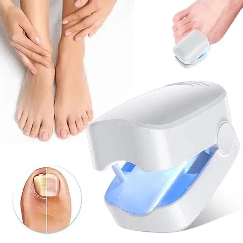 Portable-Nail-Assist-Tool-Nail-Enhancer-Fungal-Inhibition-with-Light ...