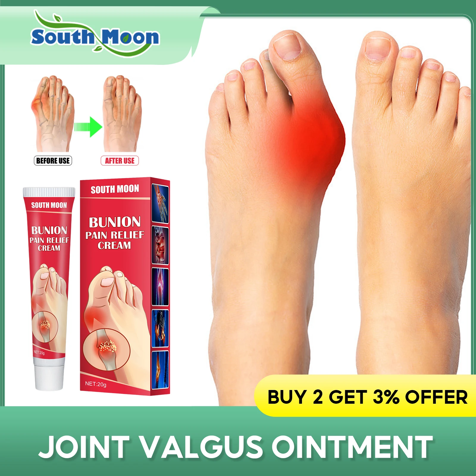 Gout-Pain-Relief-Ointment-Cure-Bunion-Hallux-Knee-Valgus-Corrector ...
