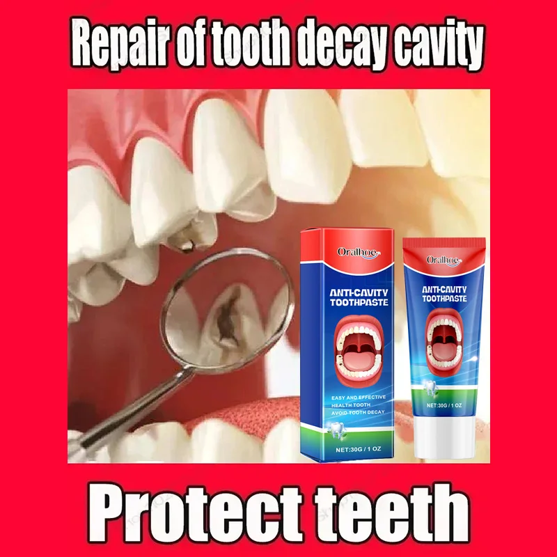 30g-Anti-Decay-Toothpaste-Dental-Caries-Repair-Cream-Prevent-Decay ...
