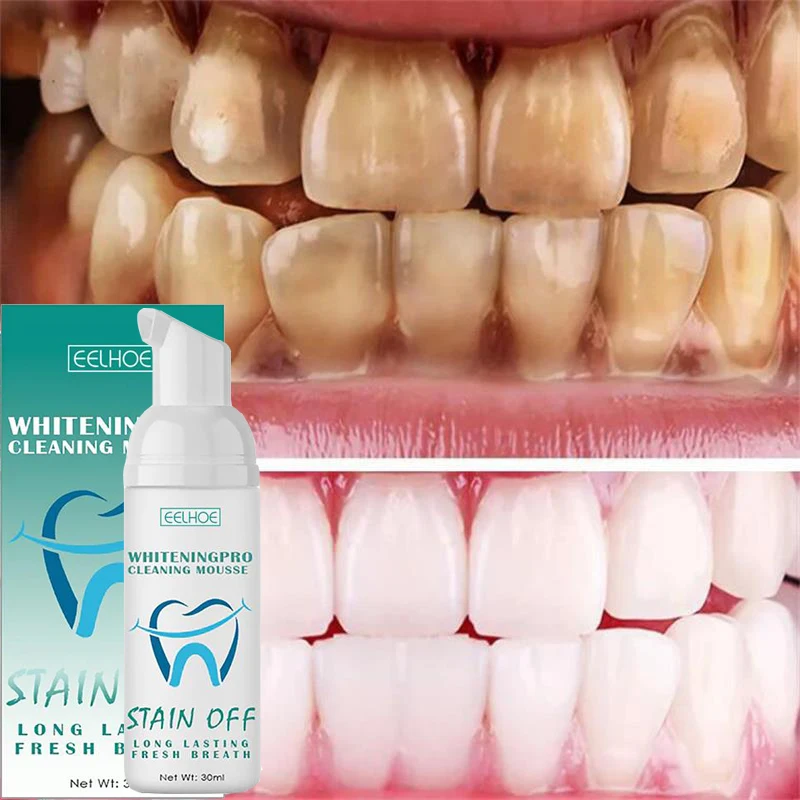 Teeth-Whitening-Mousse-Remove-Plaque-Stains-Cleaning-Oral-Hygiene-Fresh ...