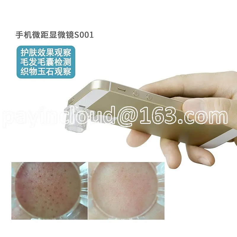 Blackhead Microscope