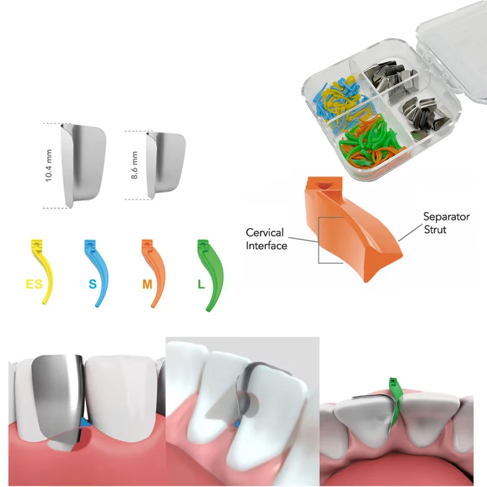 Sistema-de-matriz-Anterior-Dental-bandas-de-matriz-de-cu-a-Cu-as ...