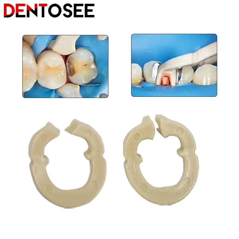 Dental-Resin-Clamping-Ring-Separator-Ring-Sectional-Contoured-Metal ...