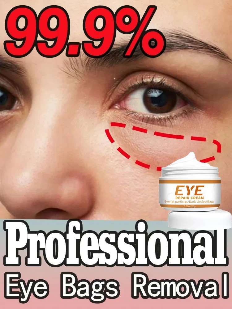 Anti-Wrinkle-Eye-cream-Remove-bags-Puffiness-Dark-Circles-under-eyes ...