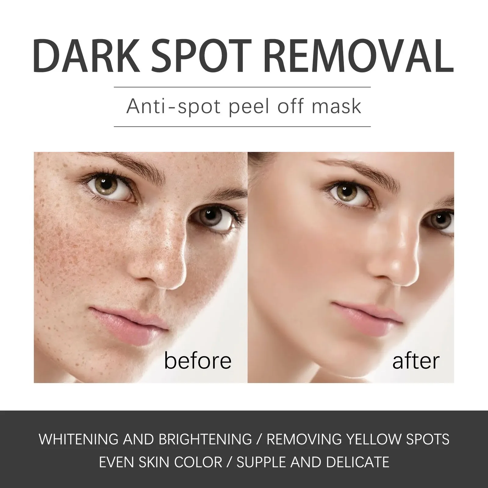 Remove Dark Spot Serum Fading Pigmentation Melasma Melanin Correcting Whitening Anti Aging ...