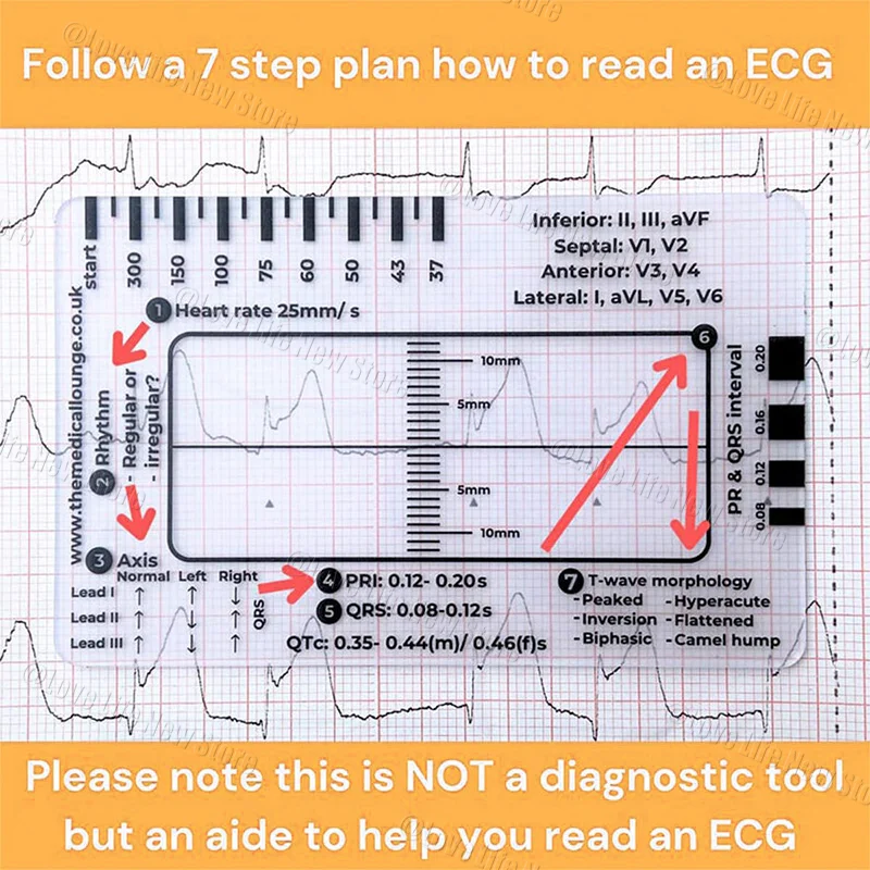 Resultados y Valores Normales de un Electrocardiograma (ECG): Guía Completa